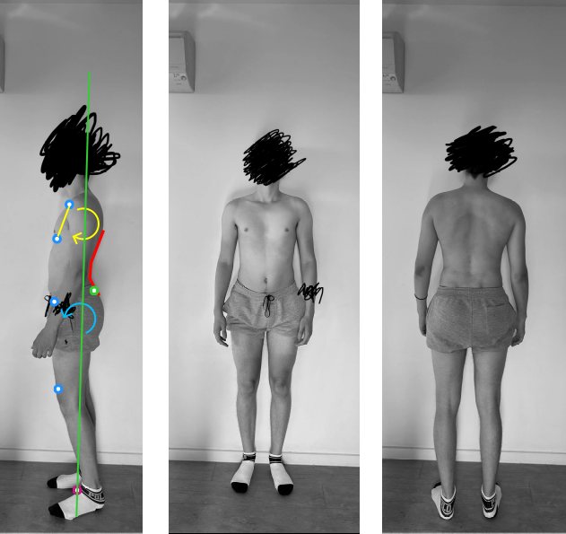 Posture assessment: SlipperySiberian | Good Posture Studio